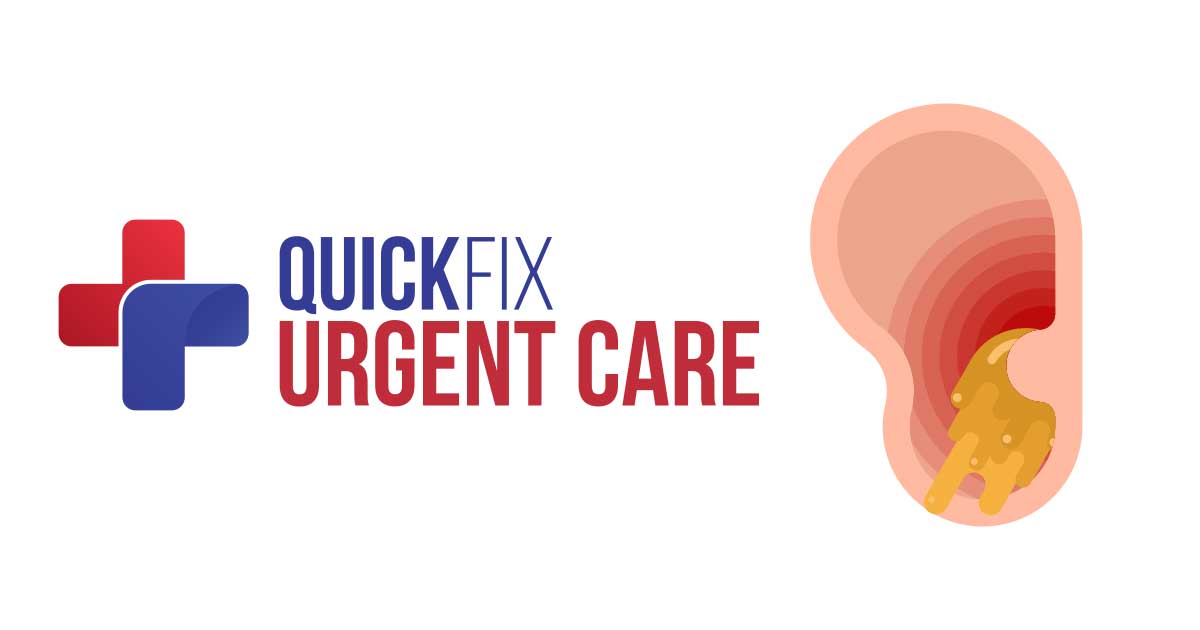 Ear Wax Lavage Treatment | QuickFix Urgent Care